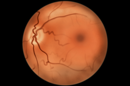 Opus Genetics Resilience Partner On Ocular Gene Therapy