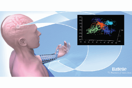 Implantable Microchip Could Restore Movement To Paralyzed Patients