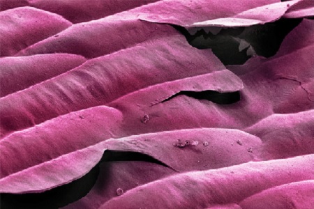 Advancements And Benefits Of Electron Microscopy In Food QAQC Practices