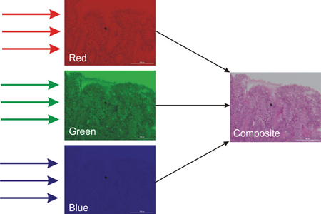 Automated Color Imaging Of Tissues