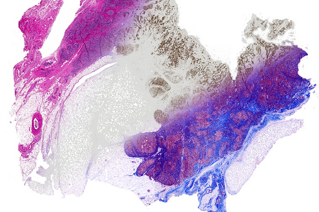 New Chemical-Free Imaging Technology Stains Tissue Samples With Light