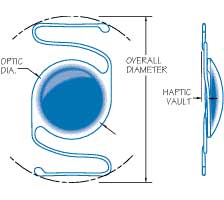 One Piece Anterior Chamber Lenses