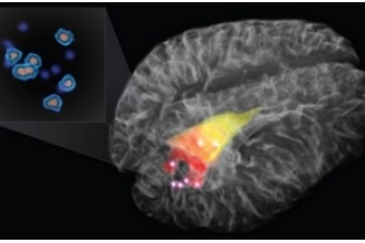 Revolutionary New Probe Zooms In On Cancer Cells