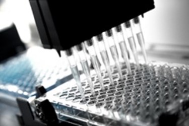 Salimetrics Uric Acid Assay Kit Enables Non-Invasive Saliva Sampling ...