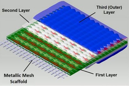 New Hybrid Heart Valve Design Combines Metal Engineered Tissue