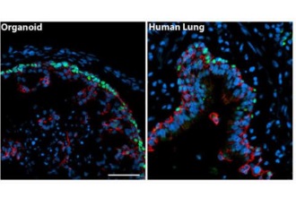 Scientists Coax Stem Cells To Form 3-D Mini Lungs
