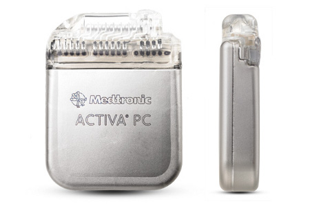 Medtronic DBS Stimulators Cleared In Europe For Full-Body MRI