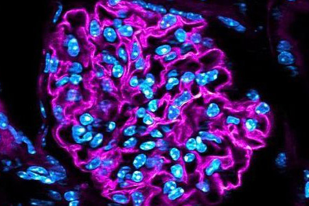 EDGE Confocal Imaging Technology