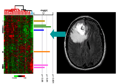 Non-Invasive Imaging Provides Window Into Genetic Properties Of Brain ...