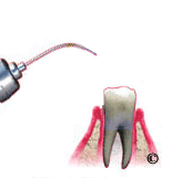 Atrix Proves Safety and Effectiveness of Systemic Drug Delivery Technology