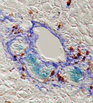 Stem Cells With Potential To Regenerate Injured Liver Tissue Identified ...