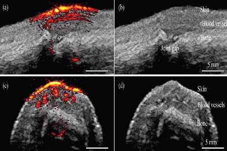 Powerful Imaging In The Palm Of Your Hands