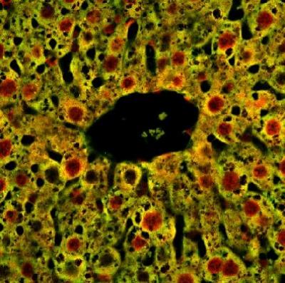 Penn Researchers Find A New Role For A 'Foxy Old Gene'