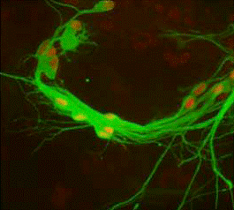 Harvard-Columbia Team Creates Neurons From ALS Patient's Skin Cells