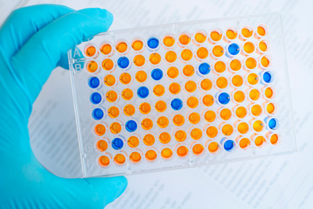 ELISA Guide Everything You Need To Perform Your ELISA Experiments
