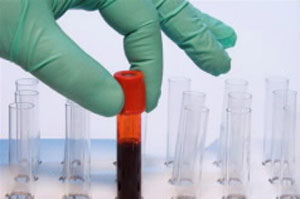 First Paper ‘Dipstick’ Test For Determining Blood Type