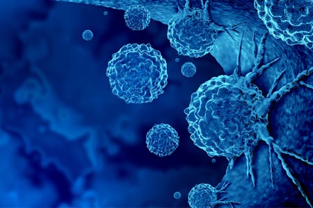 Prostate Cancer Researchers Use Organoids To Identify Critical Risk Factors