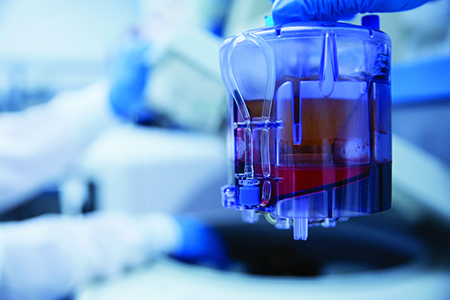 Peripheral Blood Mononuclear Cell Isolation