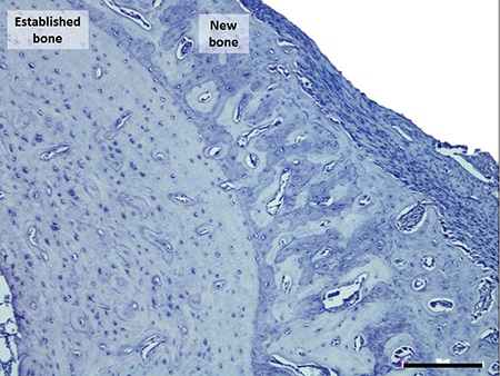 New Method Increases Targeted Bone Volume By 30 Percent
