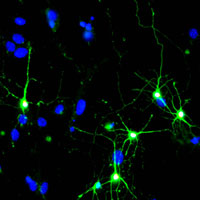 Milestone In The Regeneration Of Brain Cells: Supportive Cells Generate ...