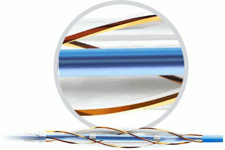 Spectranetics To Pay 230 Million For Angioplasty Company AngioScore