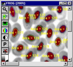 New MetaMorph BioImaging System Includes Features for Entry Level and ...