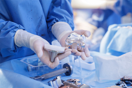Importance Of Implant Package Integrity