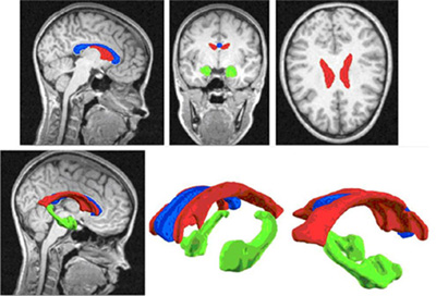 MU Researchers Study Facial Structures, Brain Abnormalities To Reveal ...