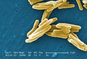 Slow-Growing TB Bacteria Point The Way To New Drug Development