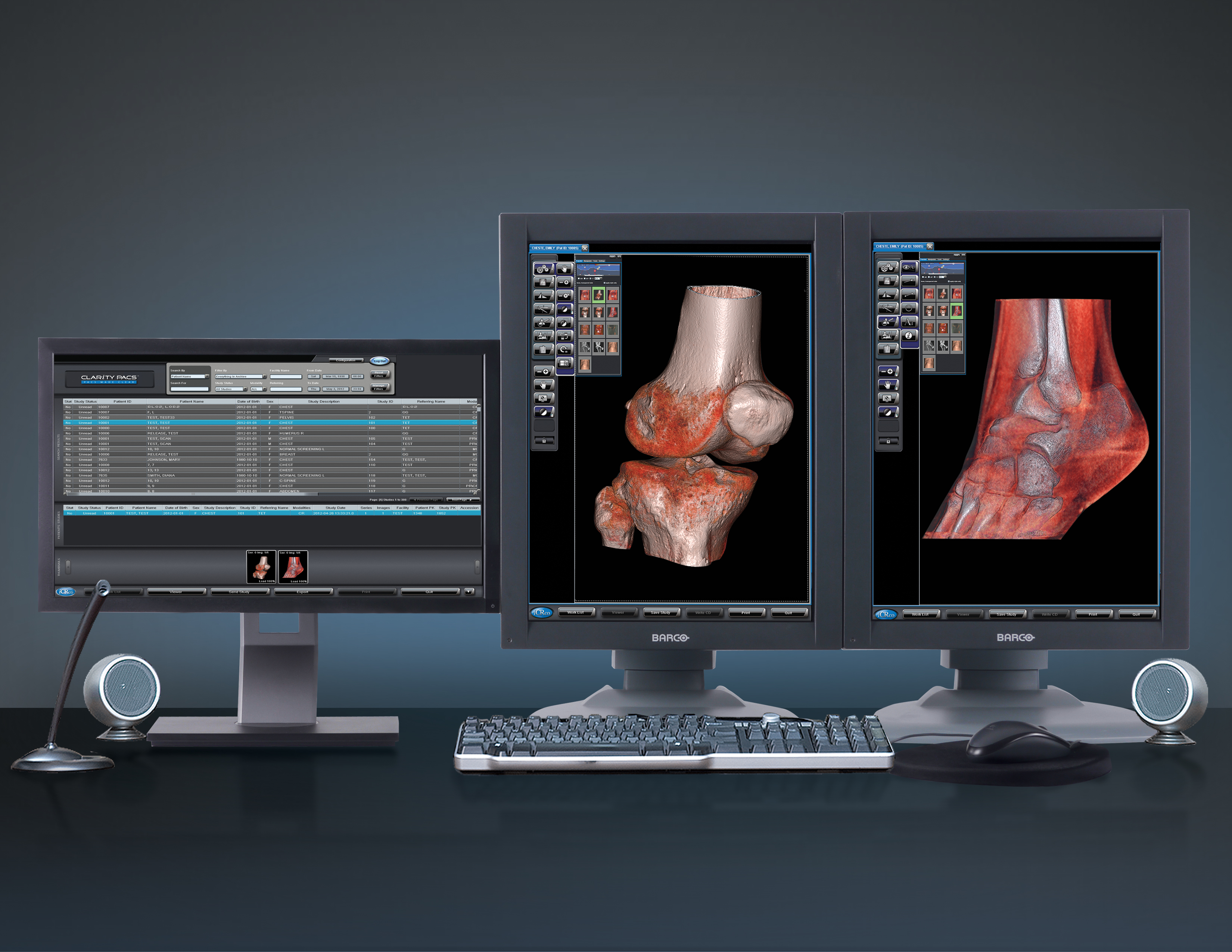 Fovia And iCRco Deliver High Definition Volume Rendering To The ...