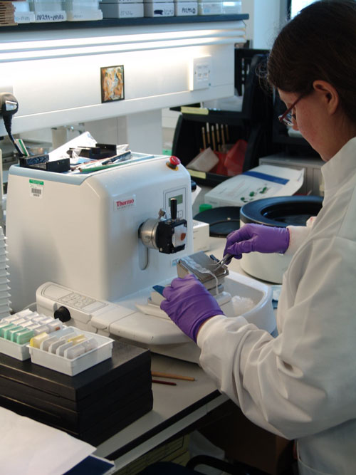 Thermo Fisher Scientific Microtome Improves Efficiency For Parkinson's ...