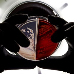 Accugenix Microbial and Identification and Strain Typing