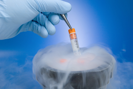 Evaluating And Improving Apheresis Material Cryopreservation Processes