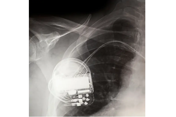 Medical Grade Capacitors MD Series