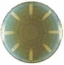 Spiral Gradient Endpoint Test