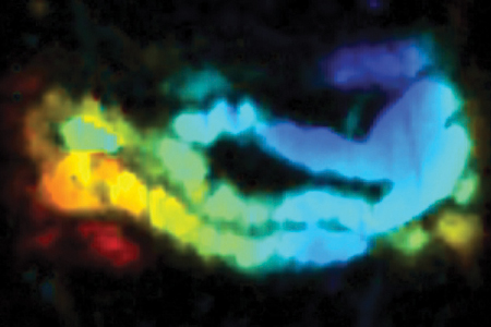 New “Nano-juice” Could Improve Gastrointestinal Imaging