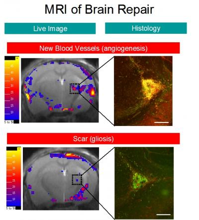 Harvard Researchers Publish MRI Images Of Genes In Action In The Living ...