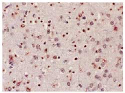 Neuron Cell - Apoptosis Detection Kits