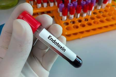 Bacterial Endotoxin Testing Part 1 Overview