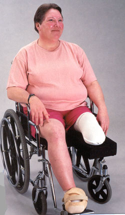 Wheelchair Support for Amputees
