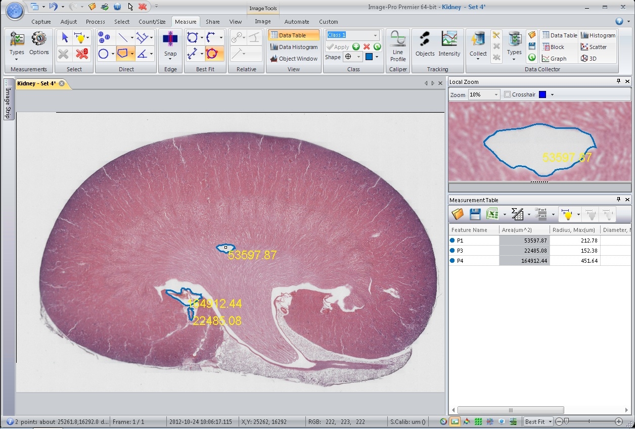 Image-Pro Premier Analysis Software Supports Objective Imaging Surveyor ...