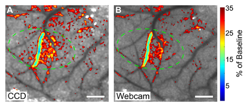 Scientists Rig Hospital-grade Lightweight Blood Flow Imager On The Cheap