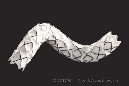 Gore's Balloon Stent Graft First To Gain FDA Approval For PAD In Iliac ...
