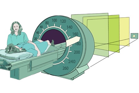 Better Math Could Make MRIs 6x Faster