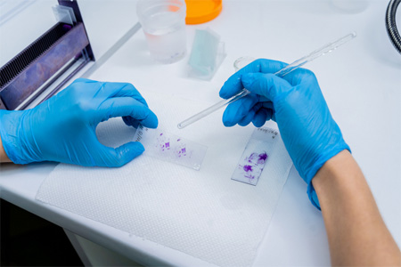 Revert Total Protein Stain Normalization Protocol