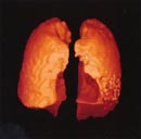 Part II Of II: Applications For Hyperpolarized Gas MRI