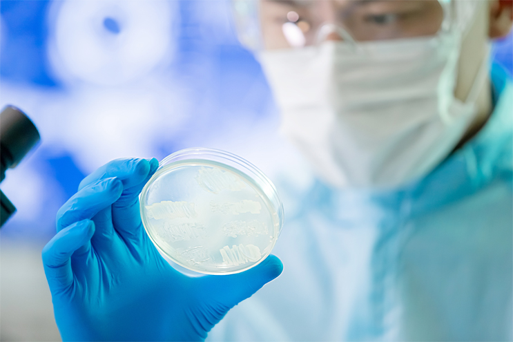 How to Identify and Quantify Adeno-associated Virus Fill States using ...