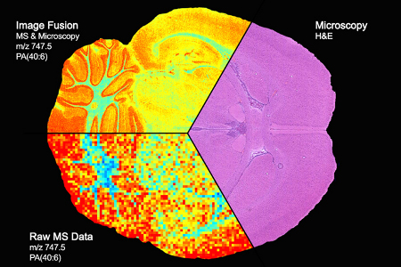 Researchers Fuse Imaging Methods For Greater Surgical Precision