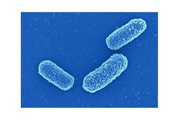 Klebsiella The Catch Of Type Ned | RIVM