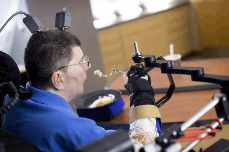 Brain Implant Restores Movement To Limbs Paralyzed For Eight Years
